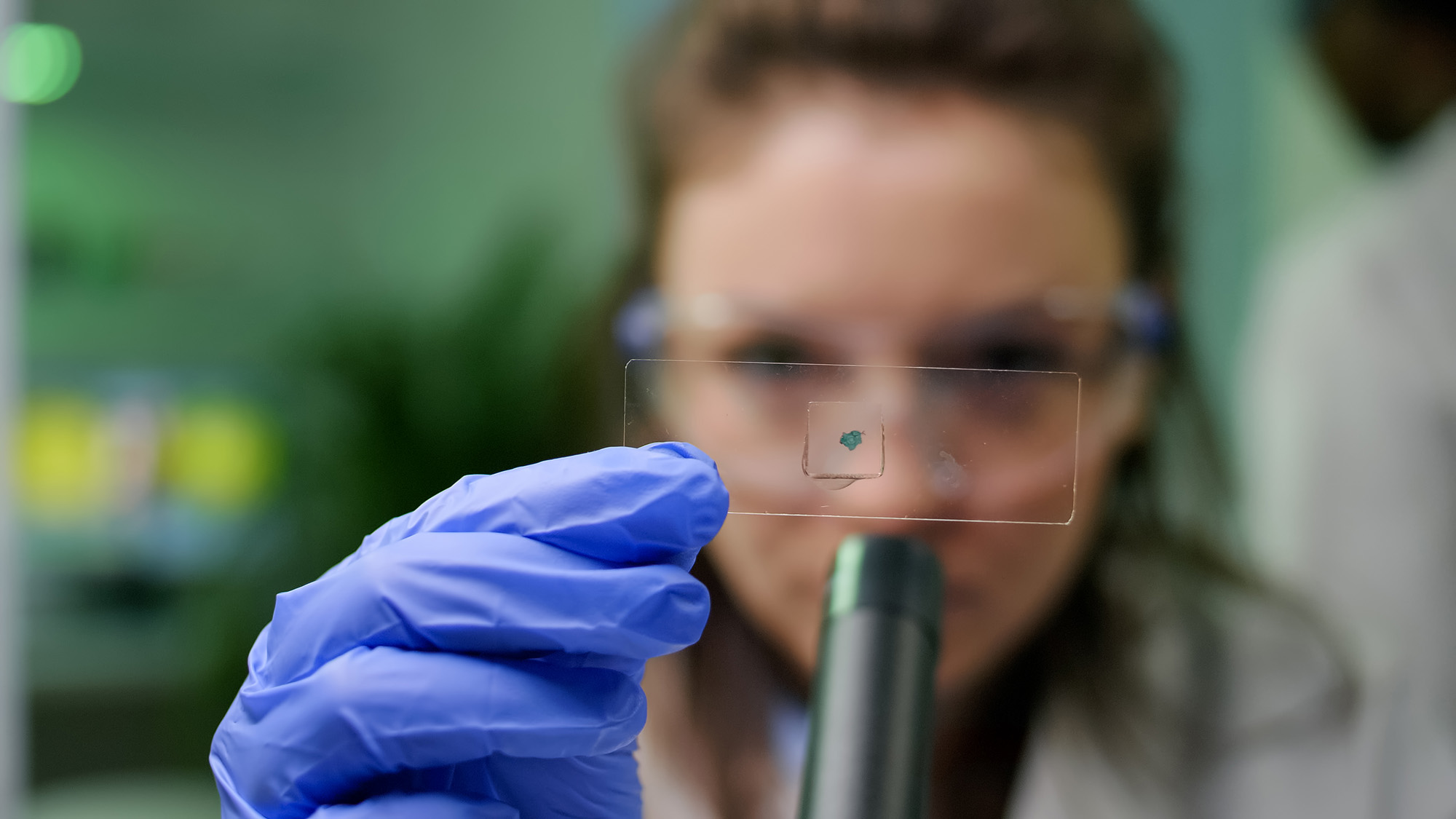 INVESTIGACIONES - ALEPI